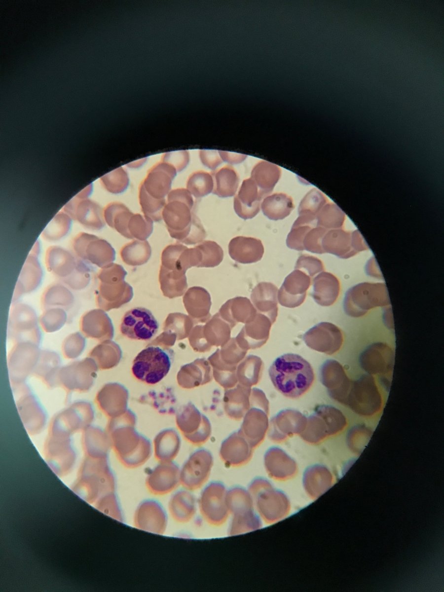 Wright's Blood Stain Kit with Bibulous Paper.