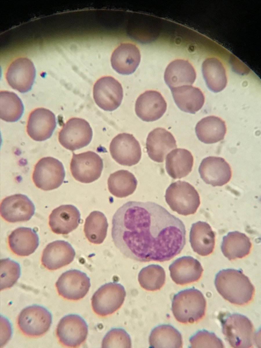 Wright's Blood Stain Kit with Bibulous Paper.